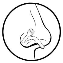 Mute – CPAP Victoria